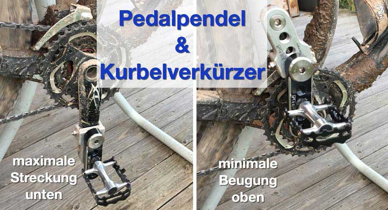 Pedalpendel Komplett Mit Kurbelarmverkrzer